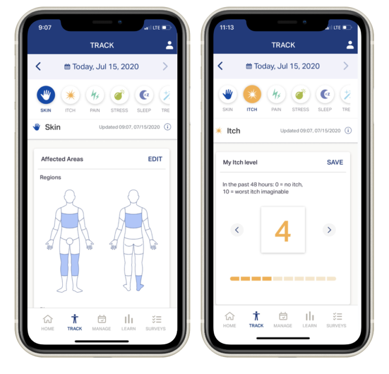 National Eczema Association | Dogtown Media